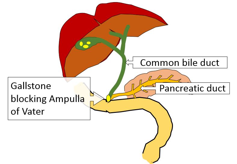 multiple pages GI Problems